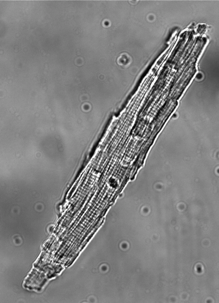 Cardiac Disease | Dr. Bin Liu, Nutritional Sciences