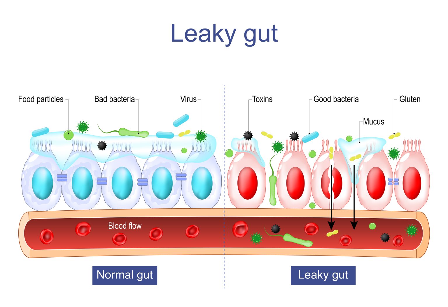 What is Leaky Gut? - UF/IFAS Extension Marion County