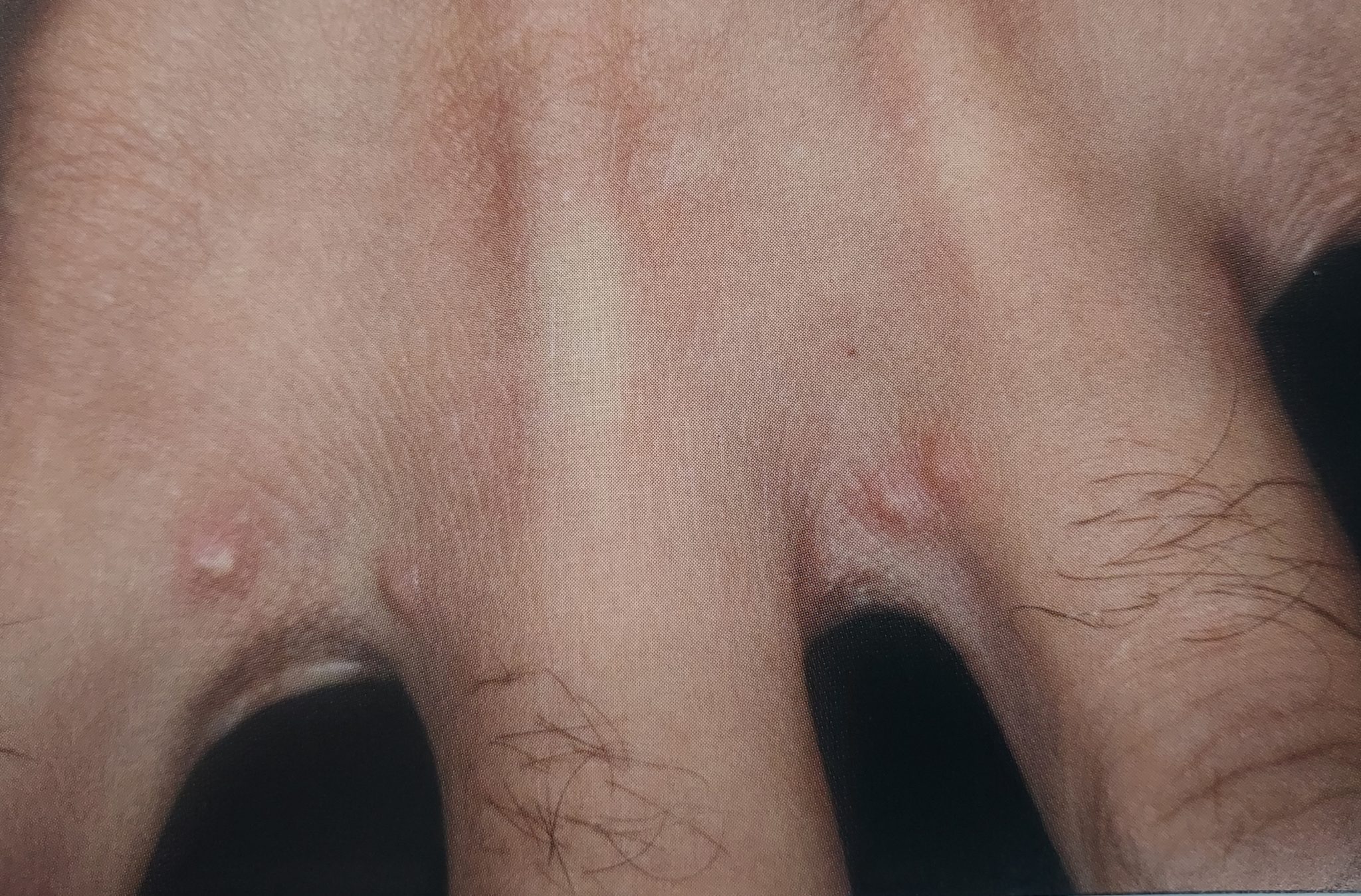 Florida Farm Pests: Red Imported Fire Ants (RIFA) - UF/IFAS Extension ...